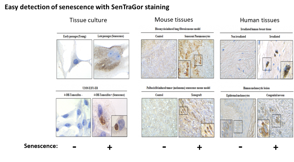 SenTraGor Spots Cell Senescence - UoM Innovation Factory