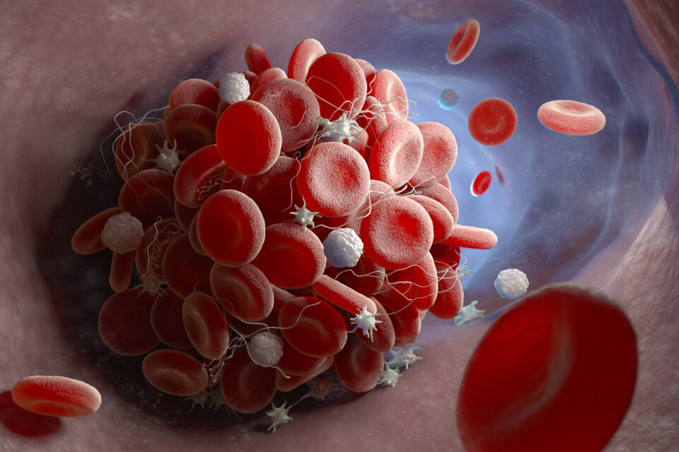 Novel Biologic: Blood-Clotting Aid - UoM Innovation Factory