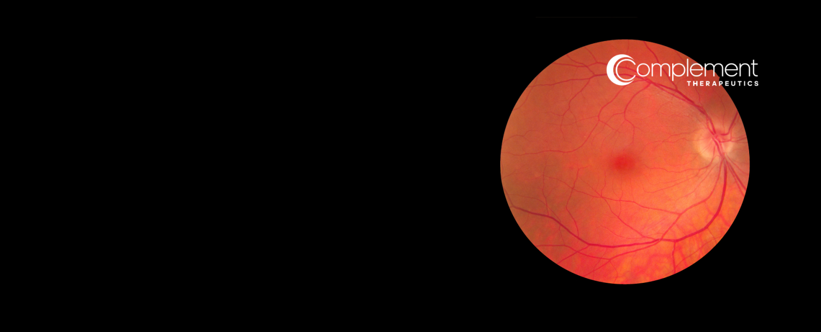 MHRA awards Complement Therapeutics Innovation Passport